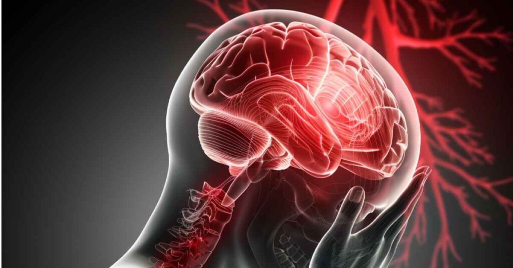 Symptoms of Brain Bleed After a Head Injury | Herbert Trial Law